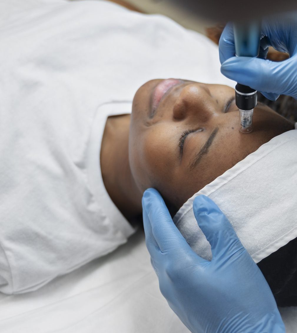 Microneedling - Youtopia Beauty